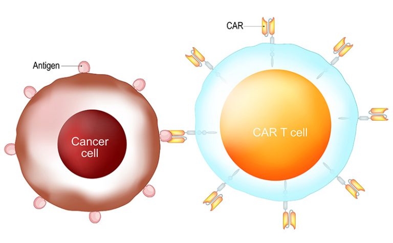 CAR-T cell Therapy - A powerful Immunotherapeutic tool - Jodas Expoim
